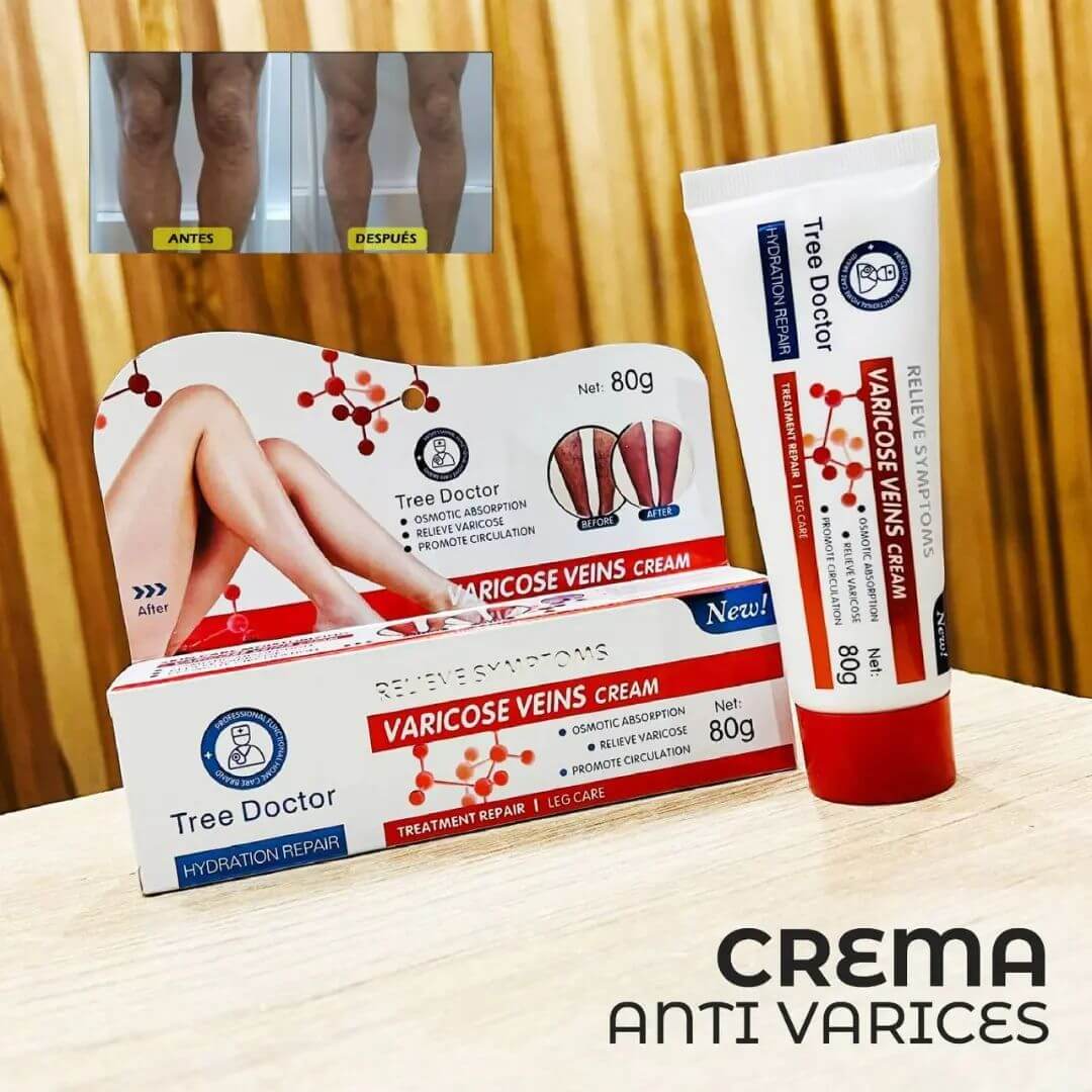 😲CREMA PARA VARICES😍 – Tienda Peru